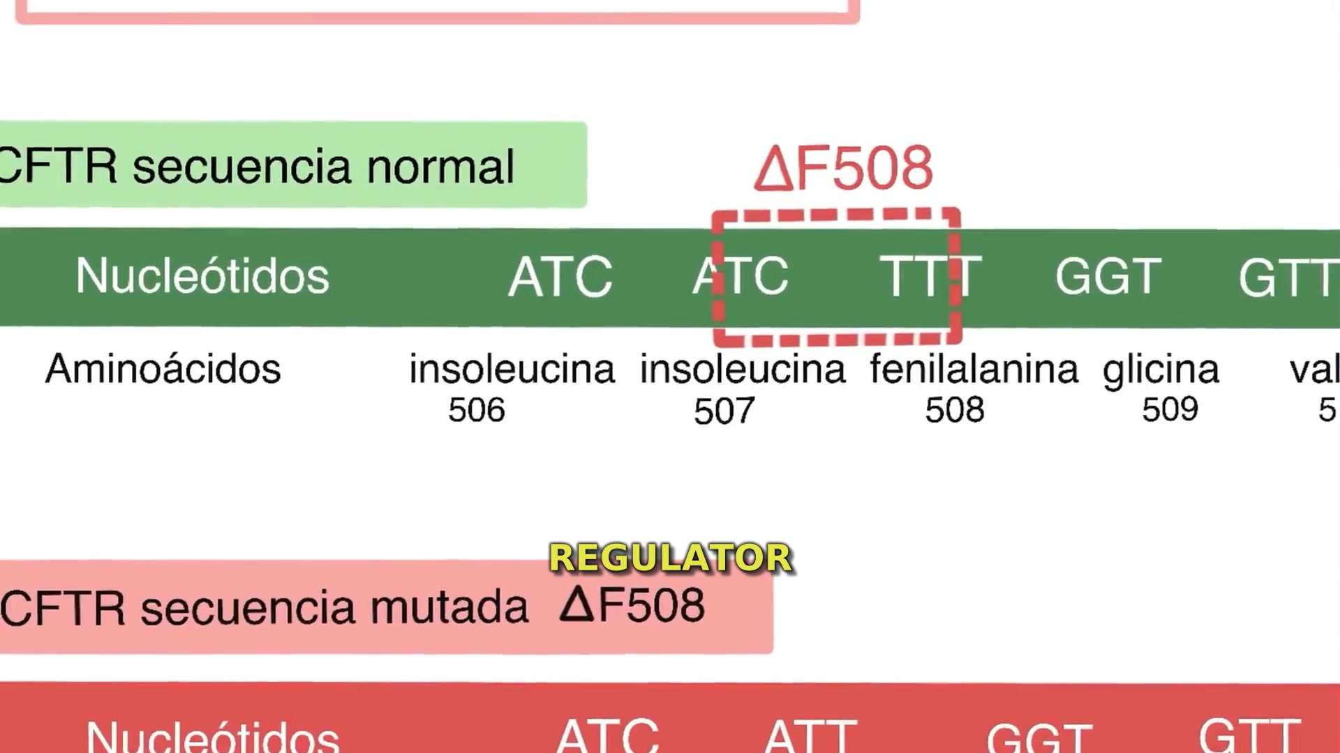 Cystic Fibrosis: Understanding the Genetic Disorder