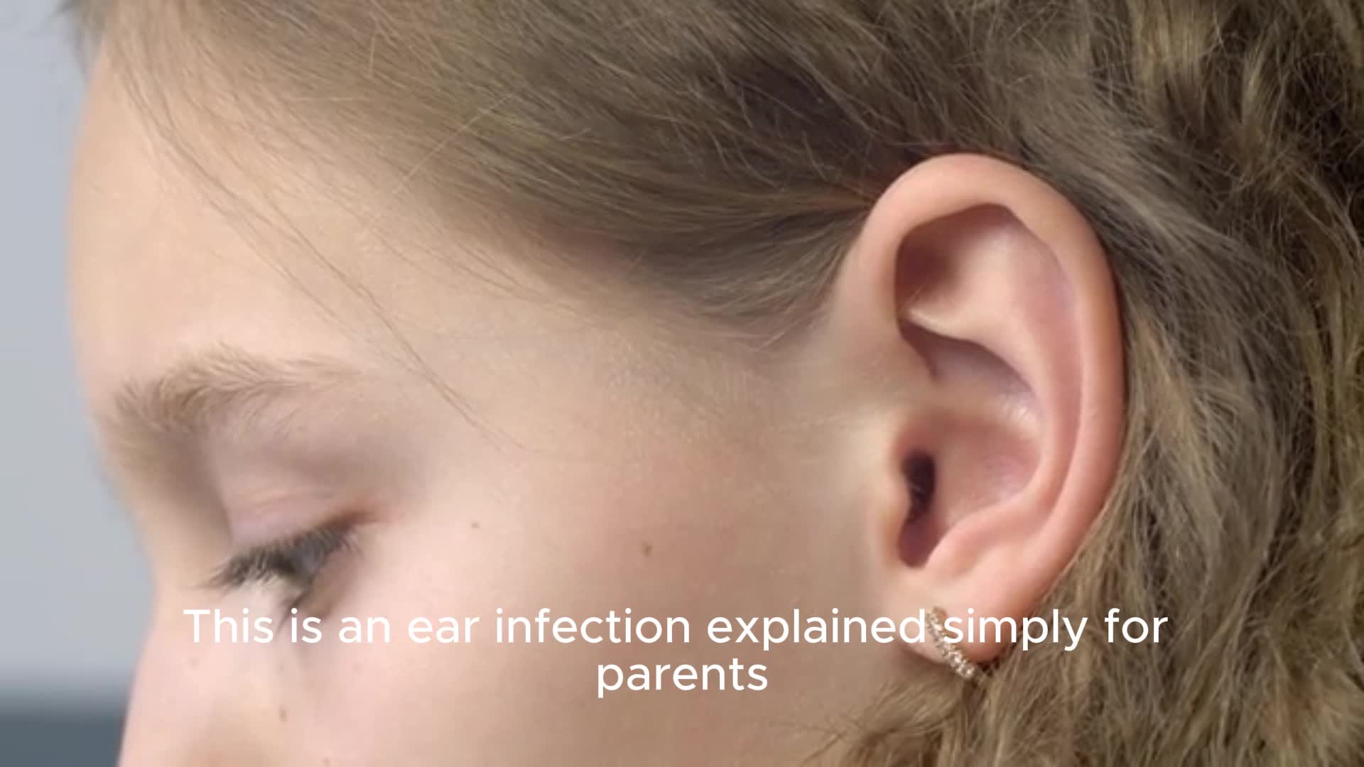 Glue Ear and Ear Infections in Children – Causes, Symptoms & Treatments ...