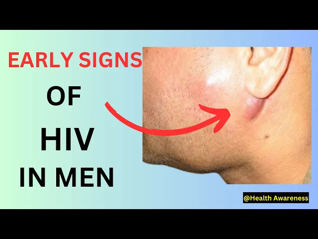 Early Warning Signs Of HIV In Men #healthawareness | Open Video