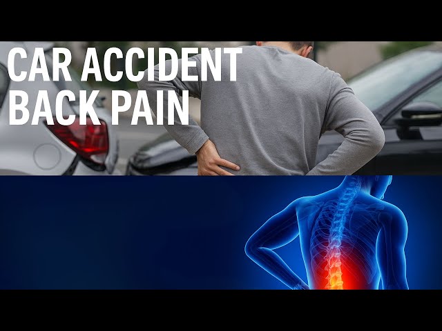 Car Accident Back Pain: Understanding Causes... | Open Video
